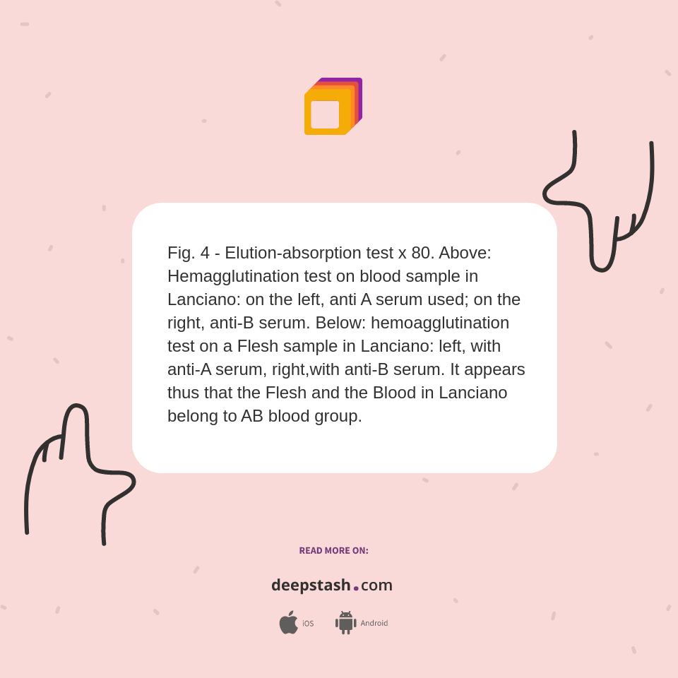Fig. 4 - Elution-absorption test x 80. Above: Hemagglutination ...
